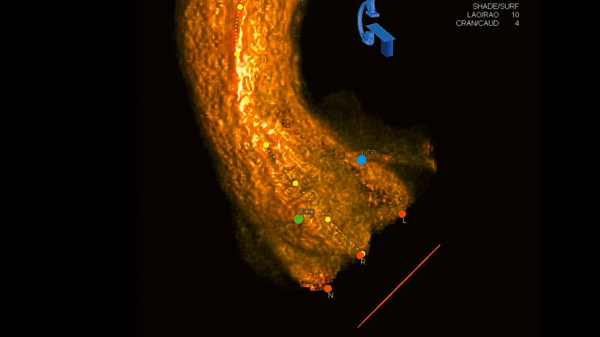 Artis Q - Siemens Healthineers