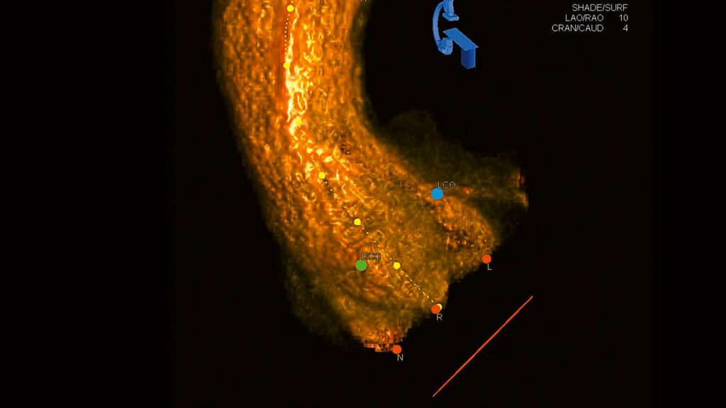 Artis Q - Siemens Healthineers