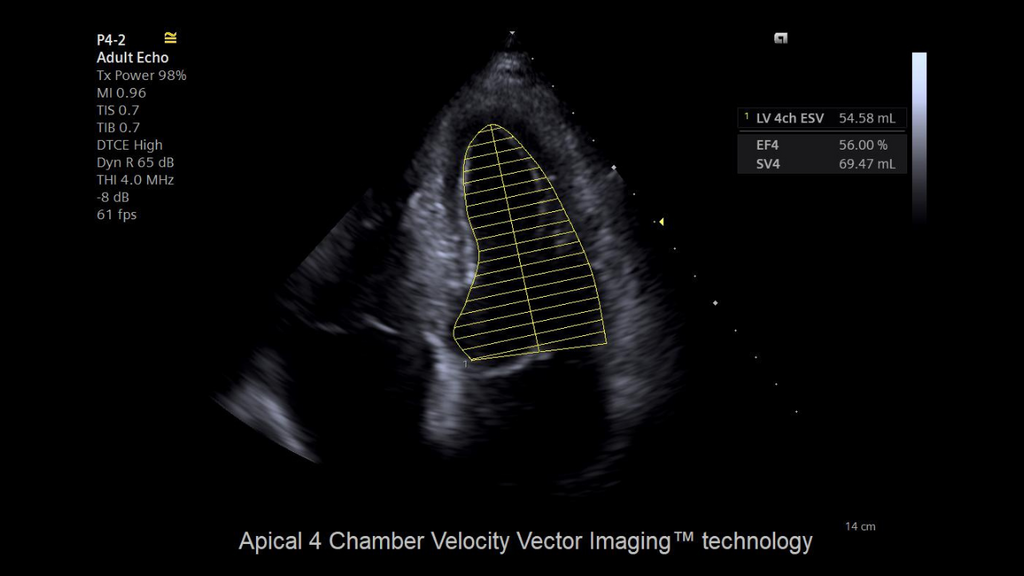 ACUSON Maple is a High-Performance Shared Service Ultrasound System ...