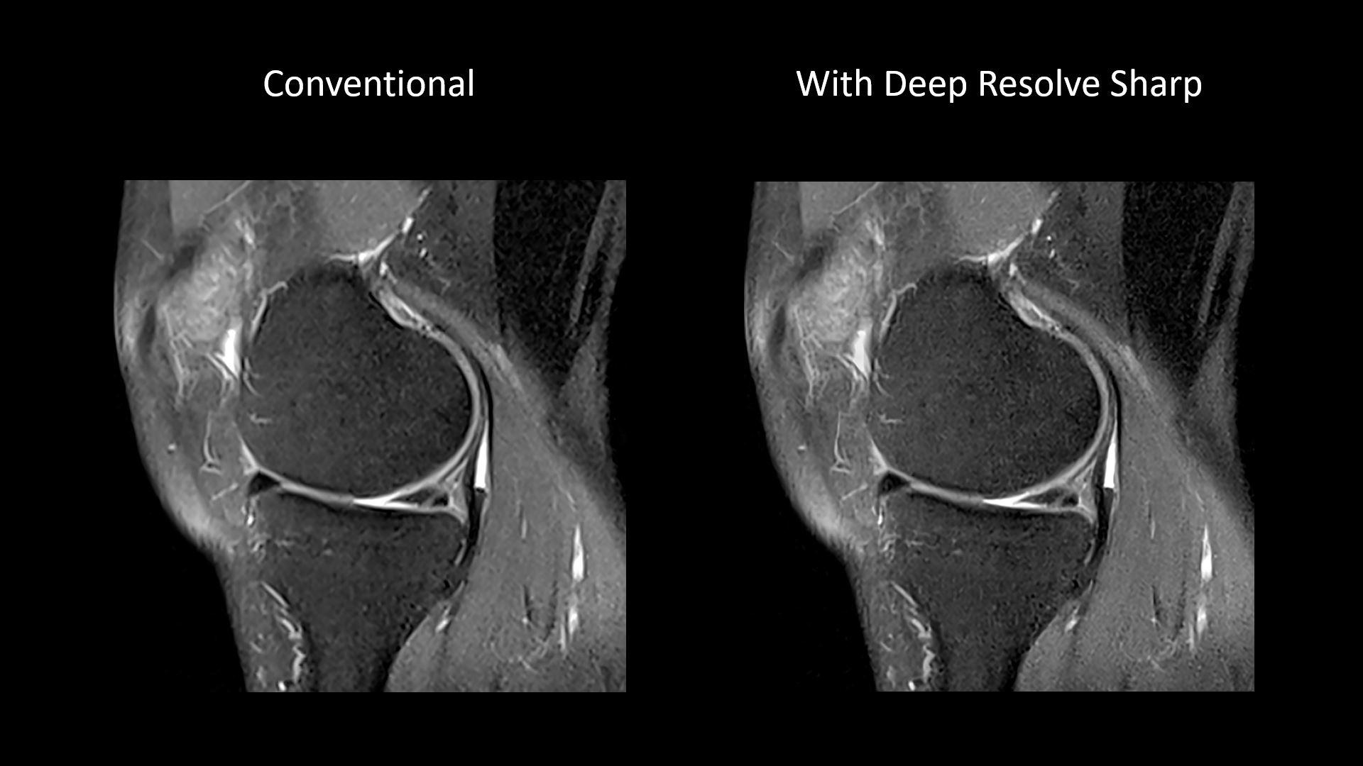 MAGNETOM Free.Max – Open Bore MRI - Siemens Healthineers USA