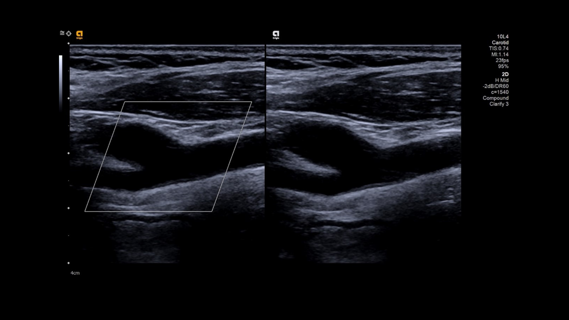 ACUSON Origin Cardiovascular Ultrasound System - Siemens Healthineers USA