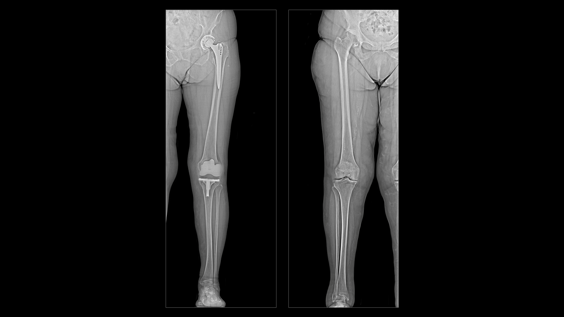 Twin Robotic X-ray scanner – Multitom Rax - Siemens Healthineers