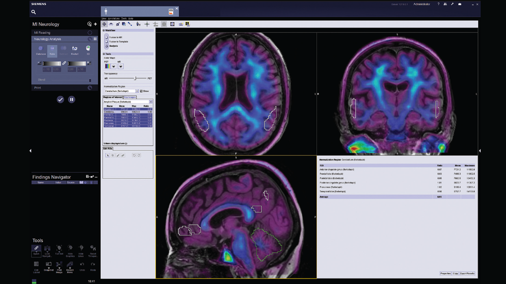 syngo.via pour l'Imagerie Moléculaire - Siemens Healthineers France