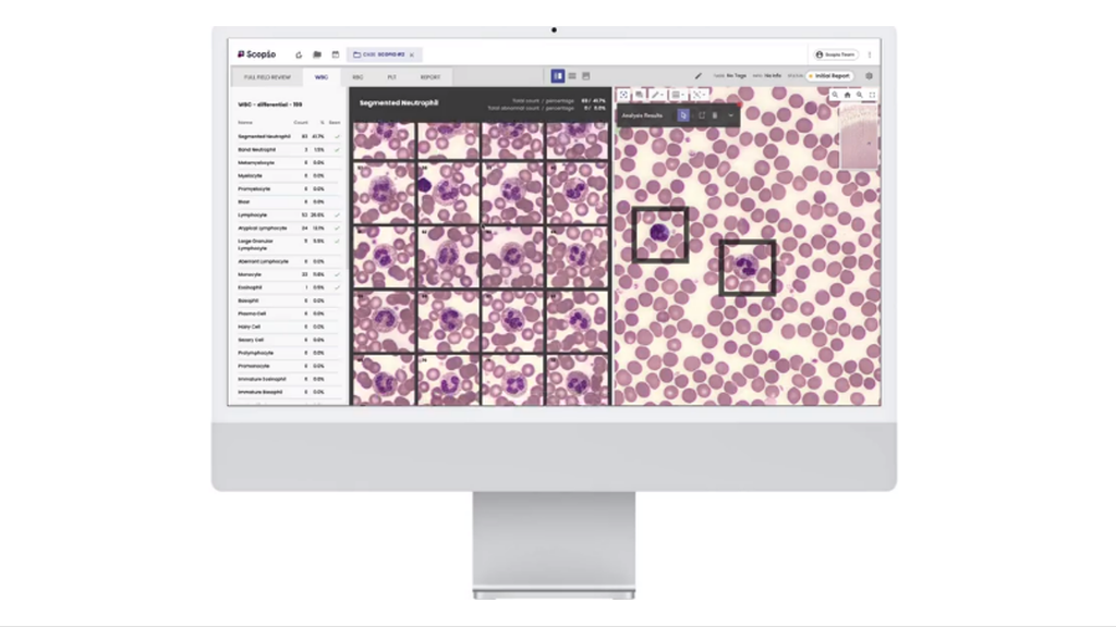 Scopio Full-field Digital Cell Morphology