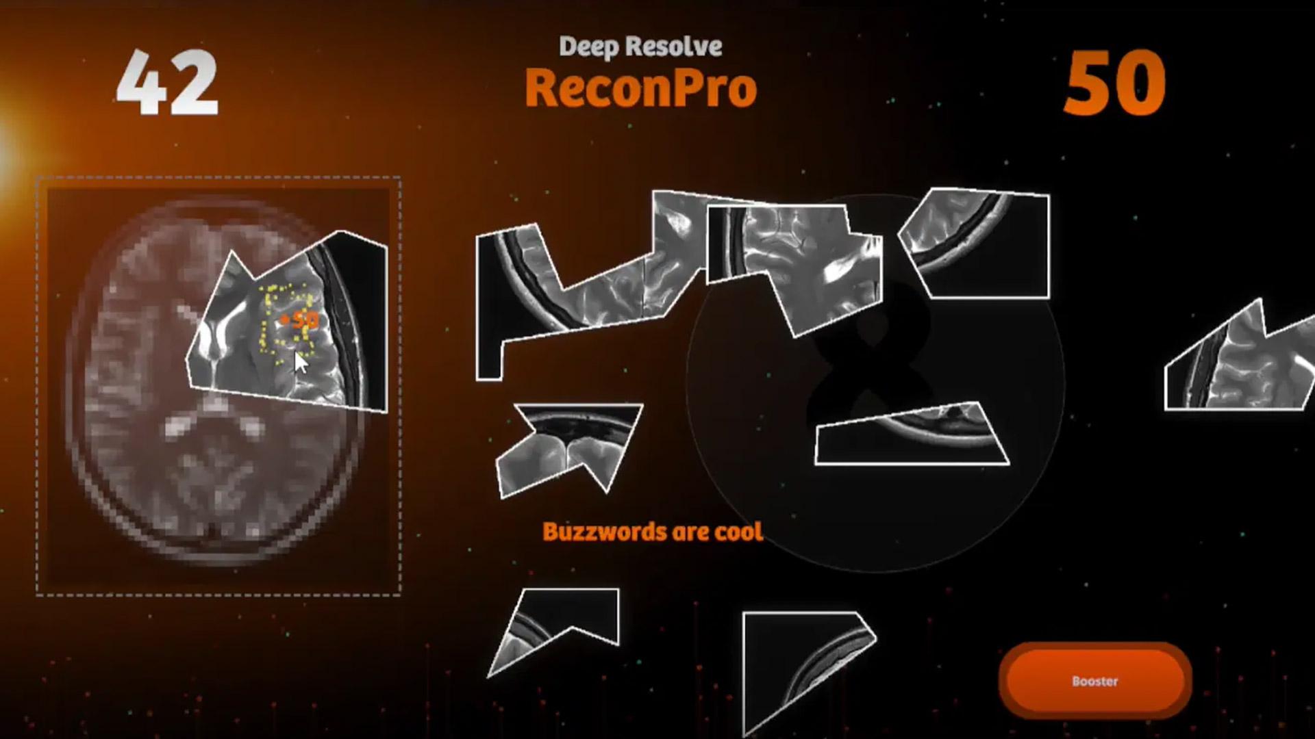 Beat Deep Resolve in the game, ReconPro - Siemens Healthineers USA