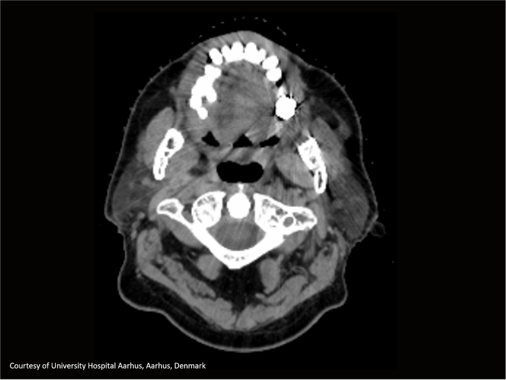SOMATOM go.Sim - Siemens Healthineers