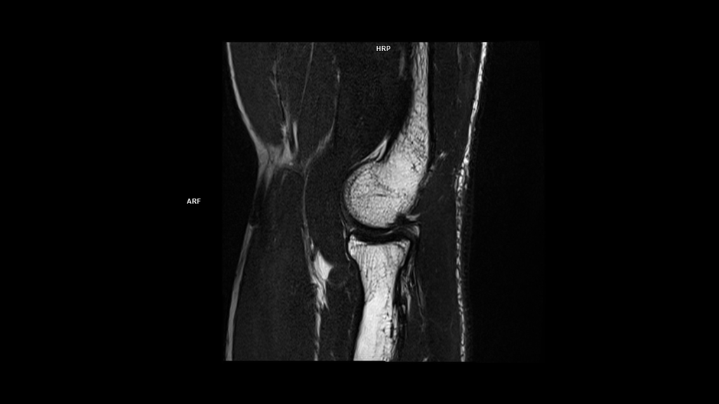 MAGNETOM Prisma - MRI Scanner - Siemens Healthineers