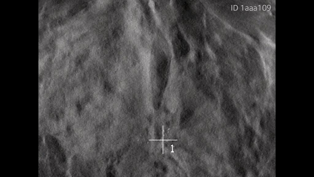 High Definition Breast Tomosynthesis – Siemens Healthineers - Siemens ...