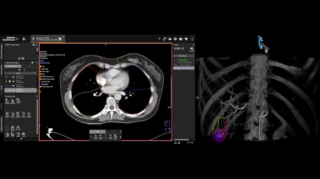 Bringing Intelligence To The Cancer Care Continuum - Siemens Healthineers
