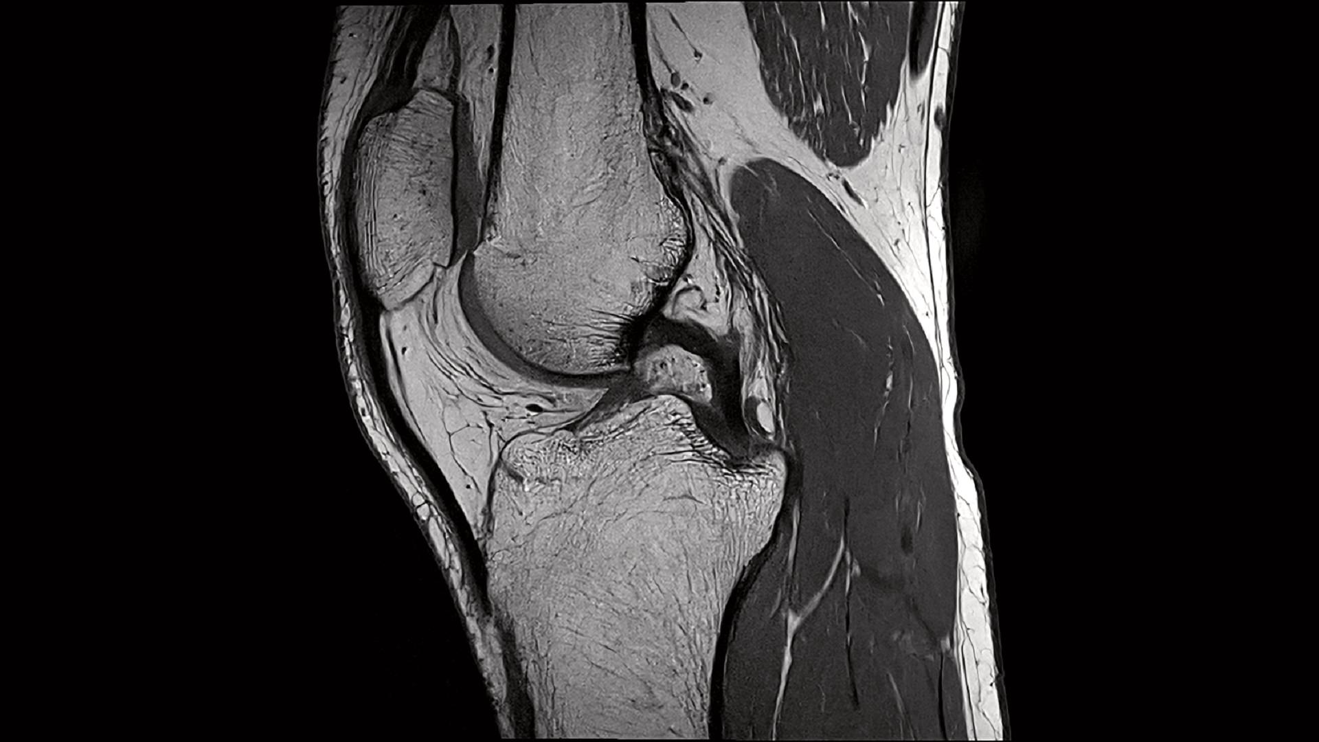 MAGNETOM Cima.X - Make the difference. - Siemens Healthineers