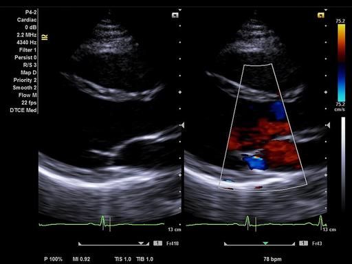 ACUSON NX2 Ultrasound System - Siemens Healthineers Türkiye