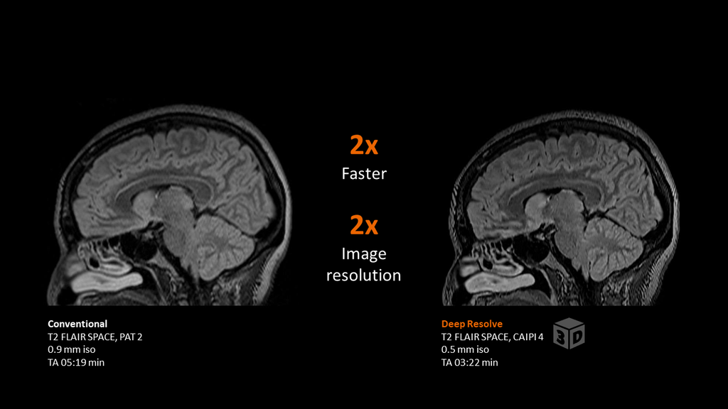 MAGNETOM Sola 1.5T MRI system with BioMatrix - Siemens Healthineers