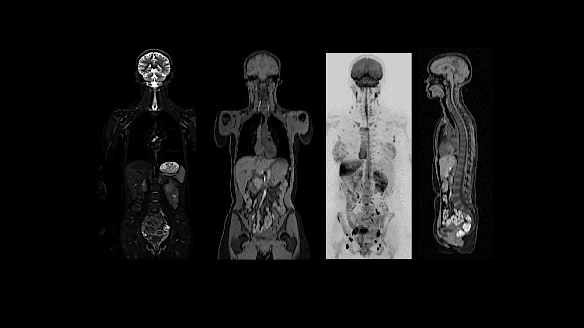 MAGNETOM Flow. Platform - Siemens Healthineers