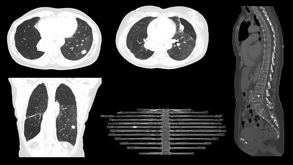 SOMATOM go.Top – Made to match - Siemens Healthineers