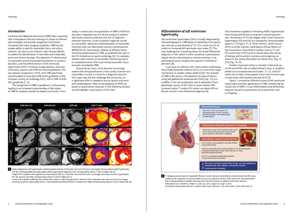 Cardiovascular MRI - Siemens Healthineers