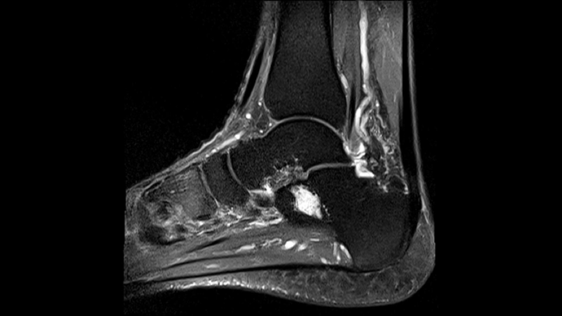 MAGNETOM Free.Max – Open Bore MRI - Siemens Healthineers USA