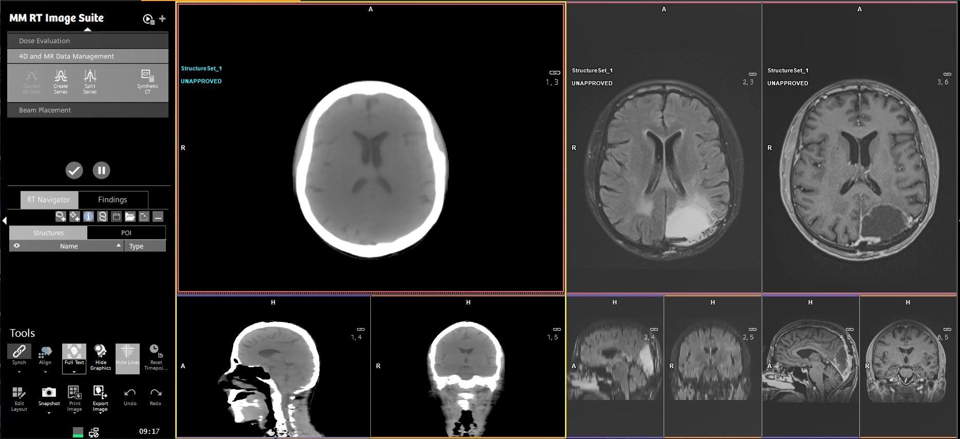 syngo.via RT Image Suite - Siemens Healthineers