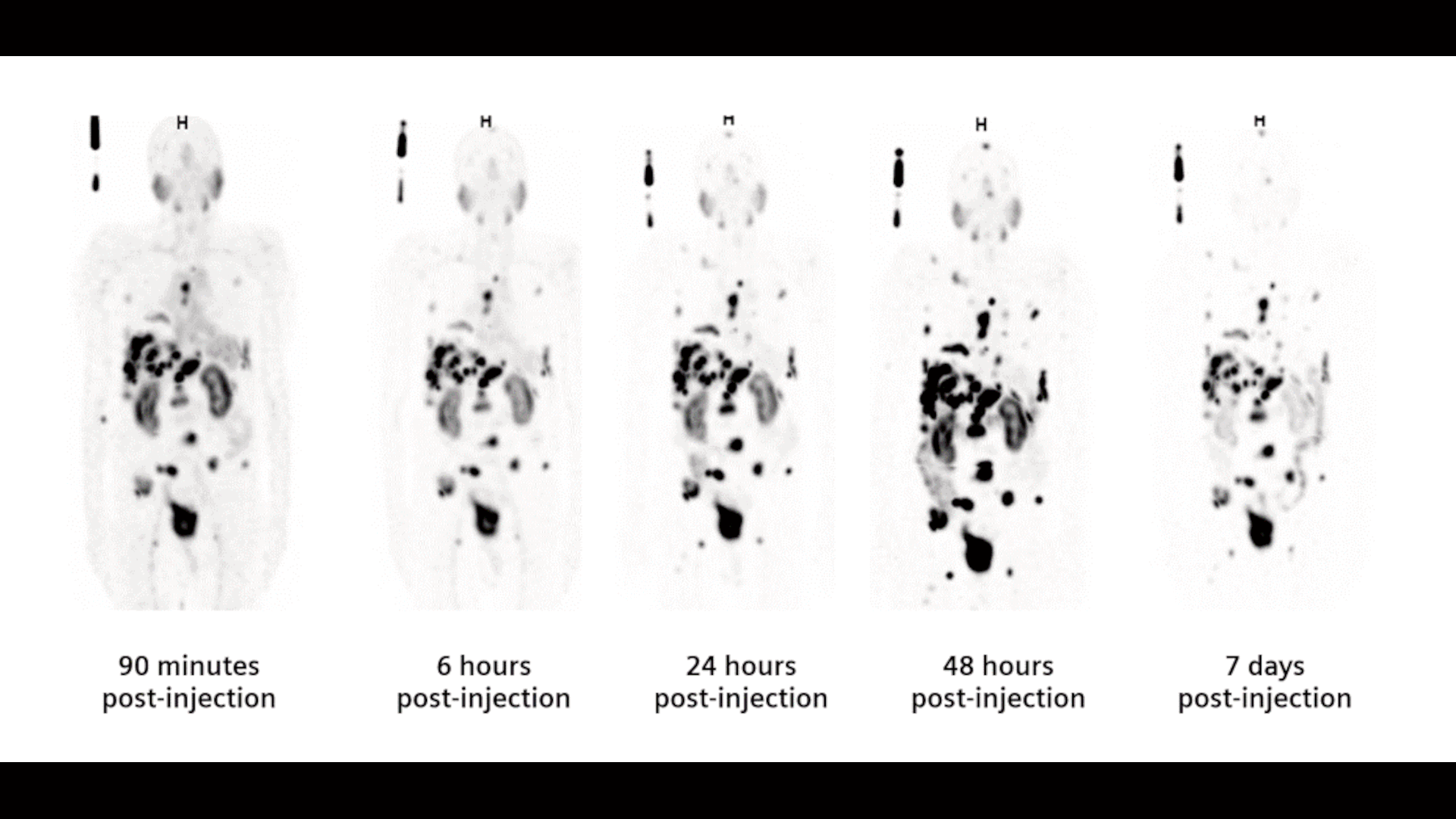 Tumor and organ dosimetry from sequential quantitative SPECT/CT