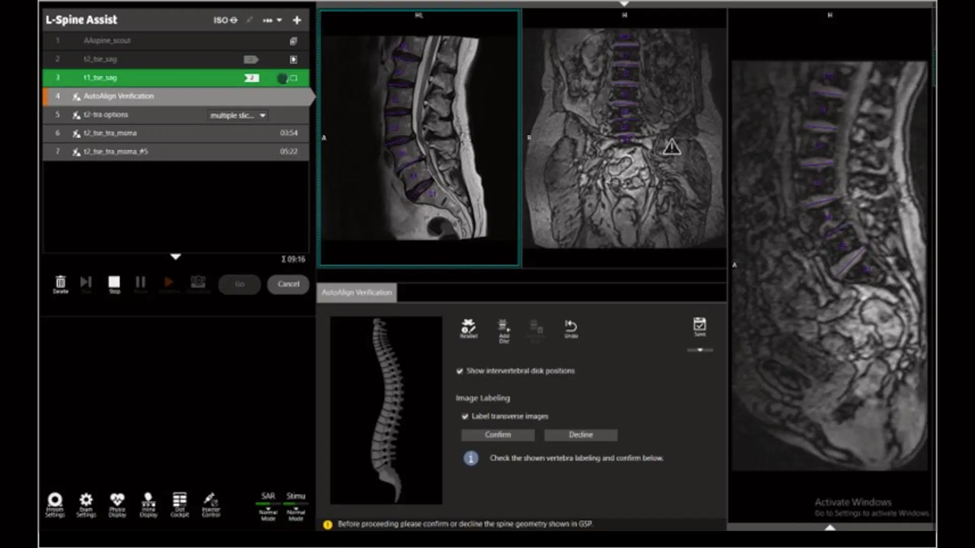 Musculoskeletal Imaging - Siemens Healthineers