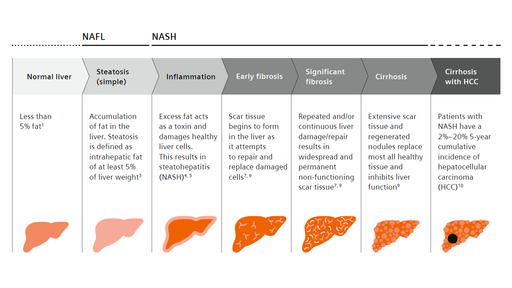 Liver Ultrasound Derived Fat Fraction (UDFF) White Paper - Siemens ...