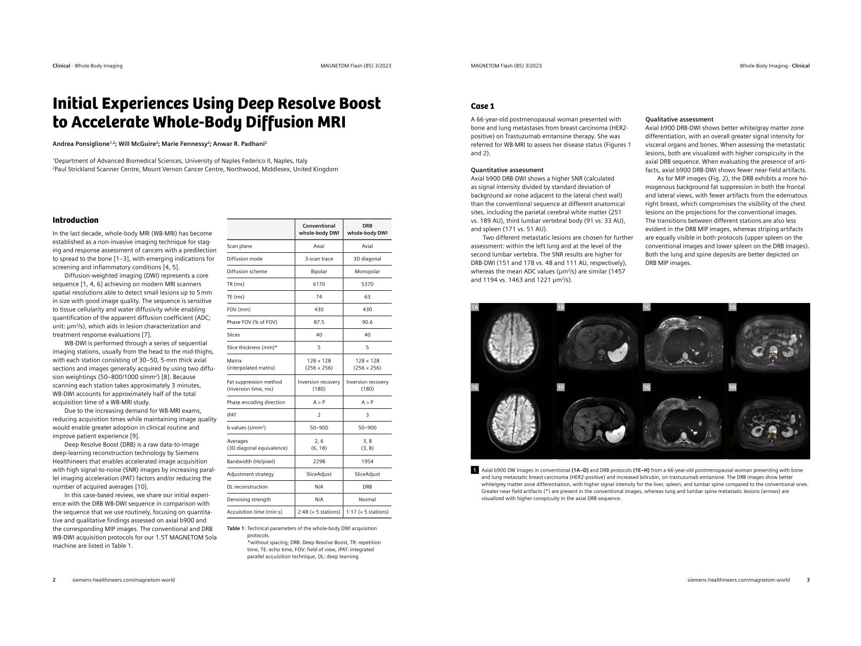 Whole-Body MRI at 1.5T in the Era of Deep Resolve