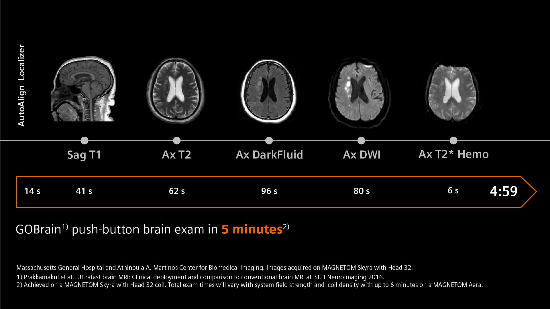Advanced stroke management and patient care - Siemens Healthineers