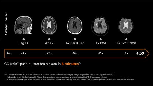 Advanced stroke management and patient care - Siemens Healthineers