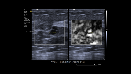 ACUSON Juniper Ultrasound System - Siemens Healthineers USA