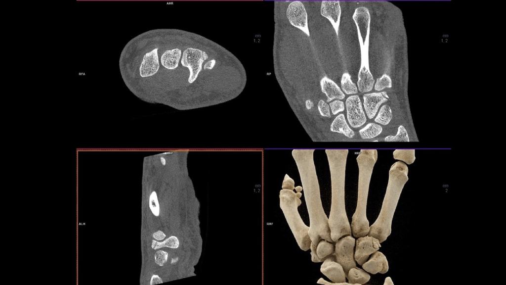 Twin Robotic X-ray scanner – Multitom Rax - Siemens Healthineers USA