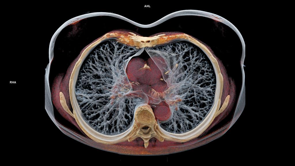 The SOMATOM go. platform – Made to match - Siemens Healthineers USA
