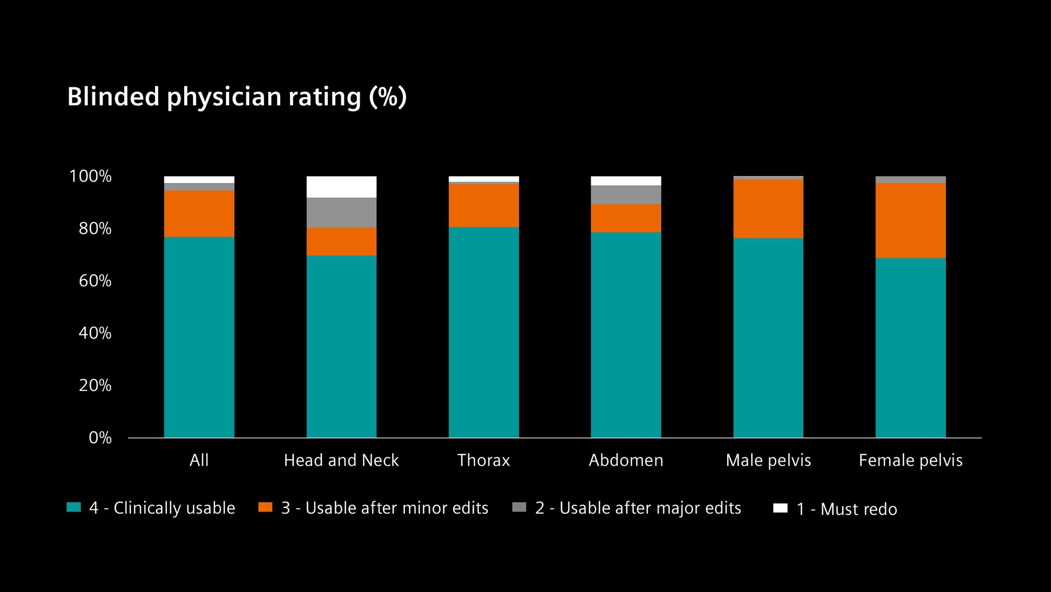Autocontouring in radiation therapy - Siemens Healthineers - Siemens ...