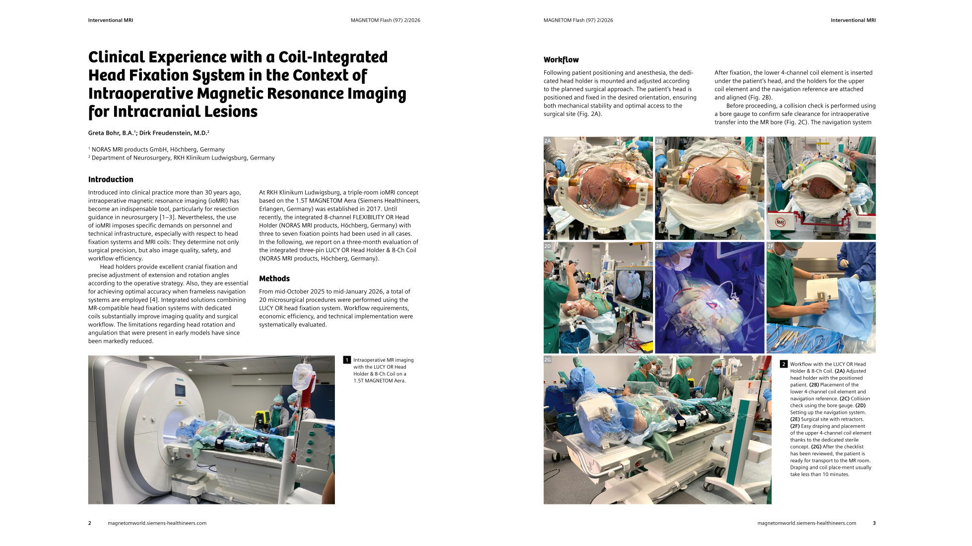 Intraoperative MRI-Guided Neurosurgery