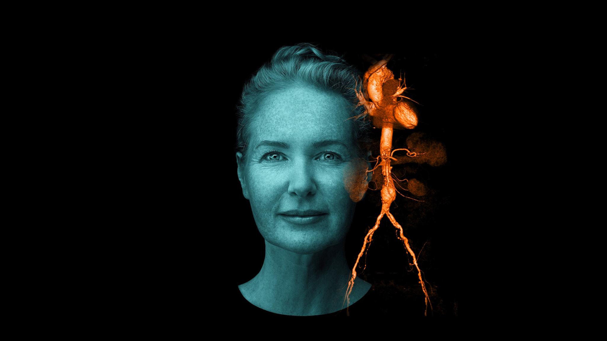 ARTIS icono floor - Siemens Healthineers USA