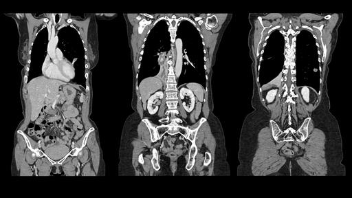 SOMATOM go.Top – Made to match - Siemens Healthineers
