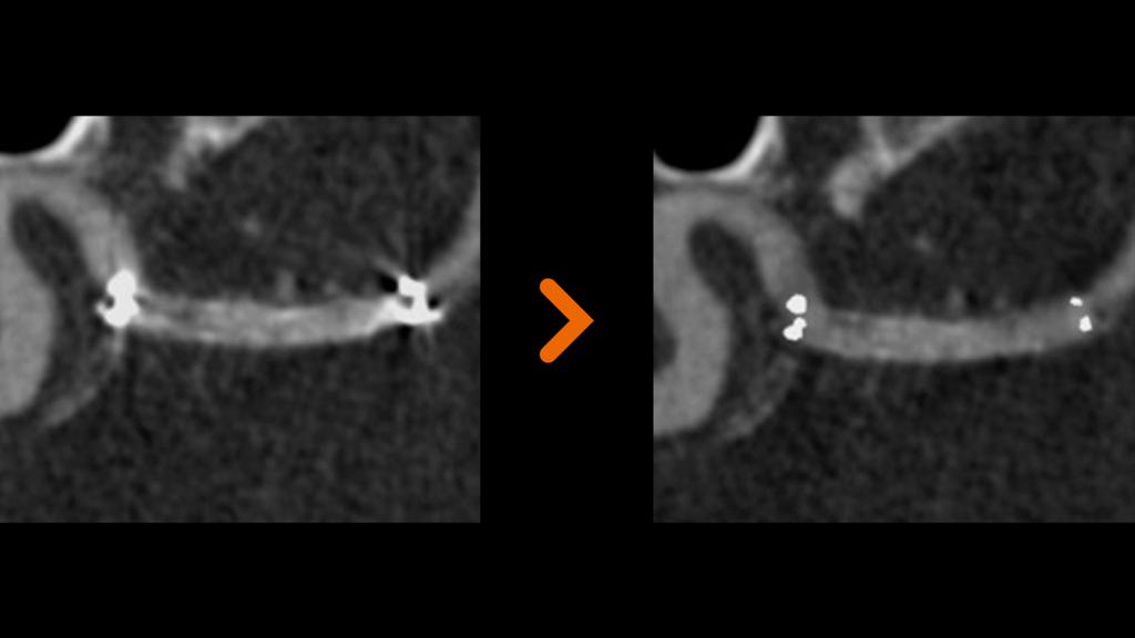 syngo DynaCT - Siemens Healthineers