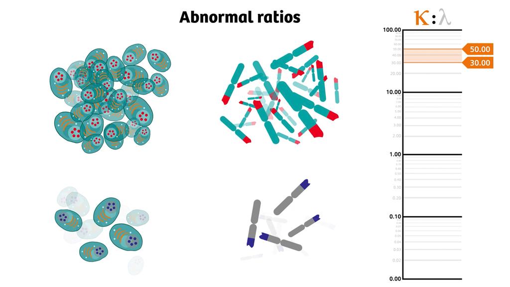 N Latex FLC kappa & lambda Assays