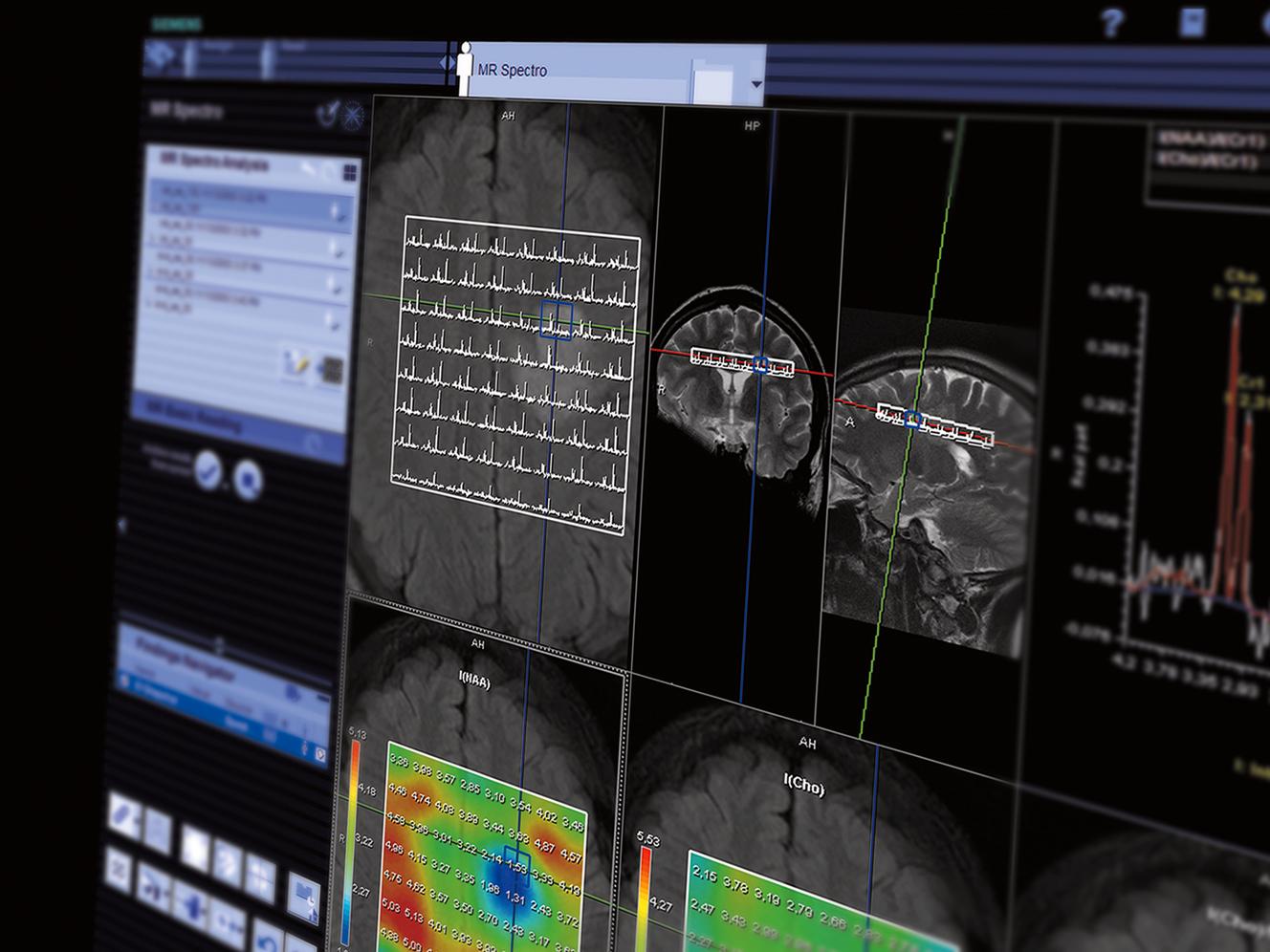 syngo.via - Siemens Healthineers USA