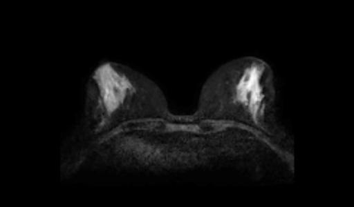 MAGNETOM Avanto Fit - Siemens Healthineers