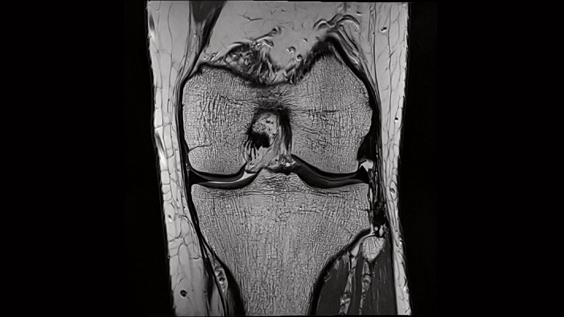 MAGNETOM Cima.X - Make the difference. - Siemens Healthineers