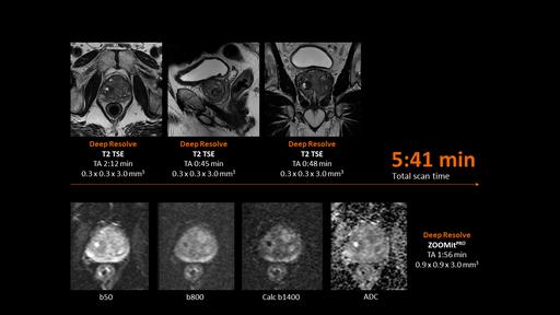 MAGNETOM Flow. Plattform – Siemens Healthineers Deutschland