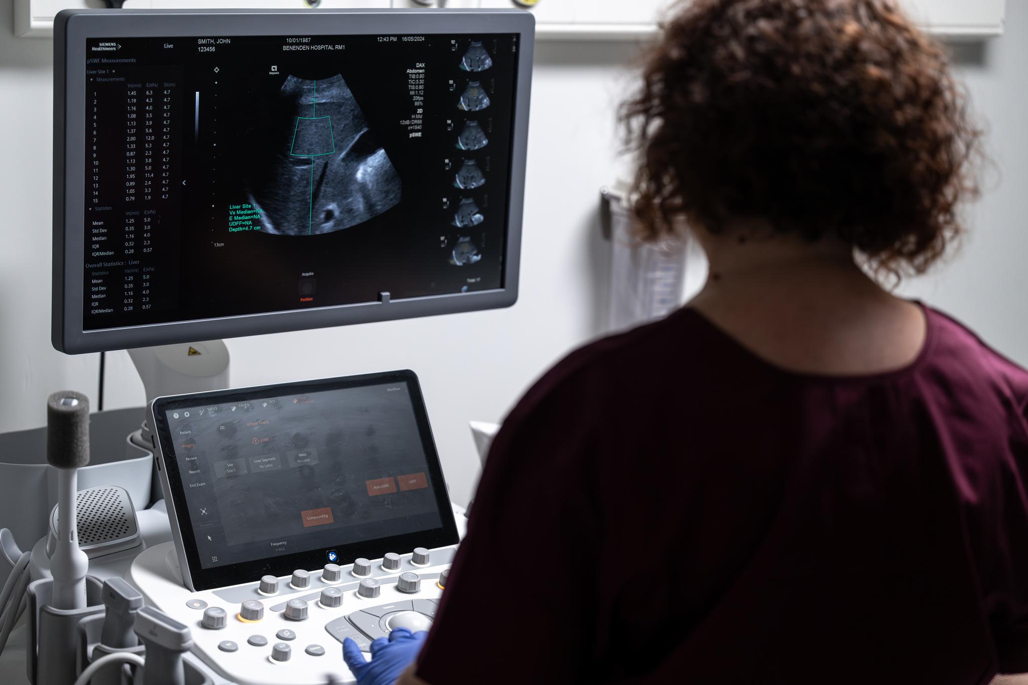 ACUSON Ultrasound Machines