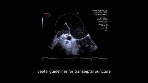 Cardiovascular Ultrasound | ACUSON SC2000 Ultrasound System - Siemens ...