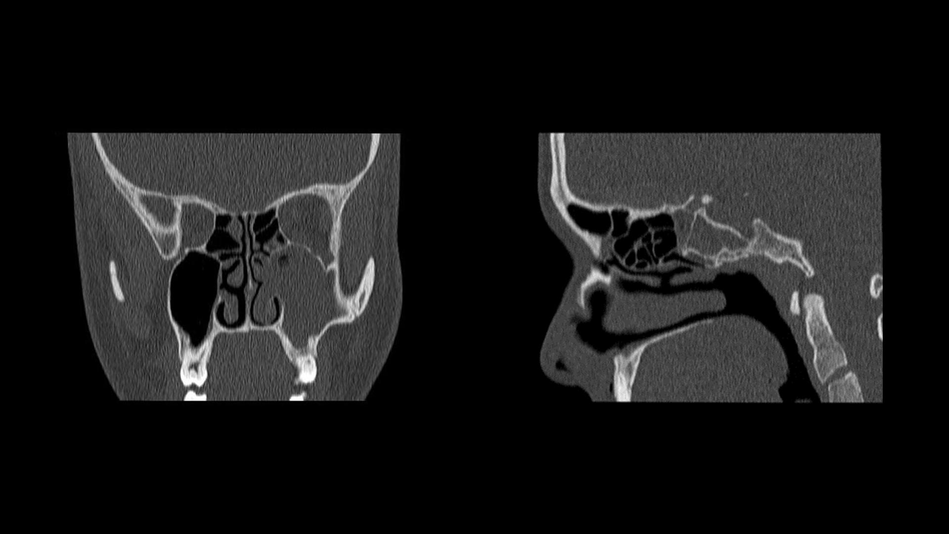 SOMATOM Drive - Siemens Healthineers USA