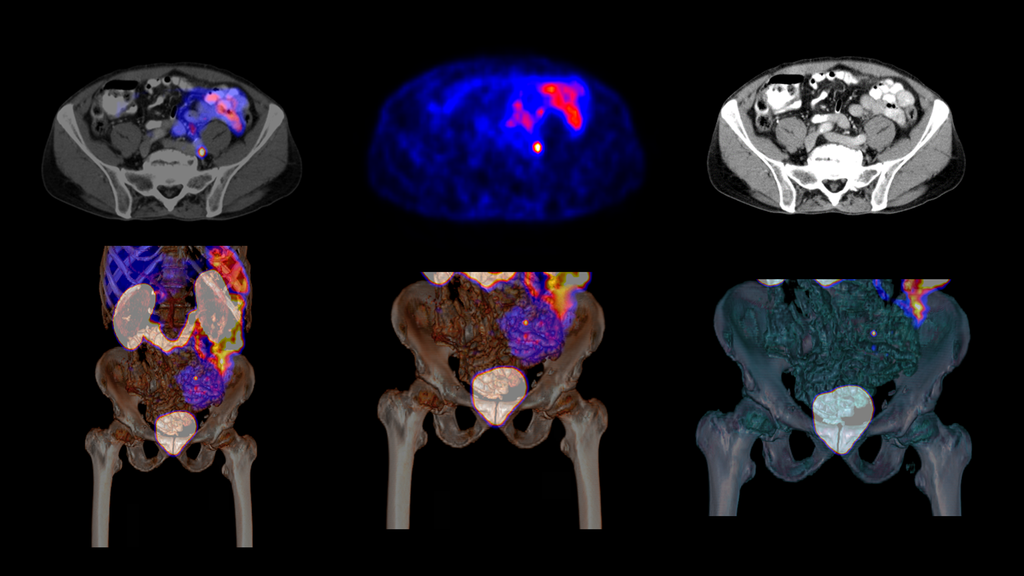 Biograph Horizon PET/CT scanner - Siemens Healthineers
