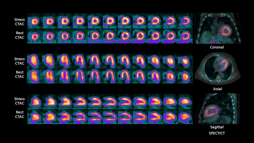Symbia Pro.specta SPECT/CT - Siemens Healthineers Japan