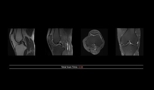 MAGNETOM Avanto Fit - Siemens Healthineers USA