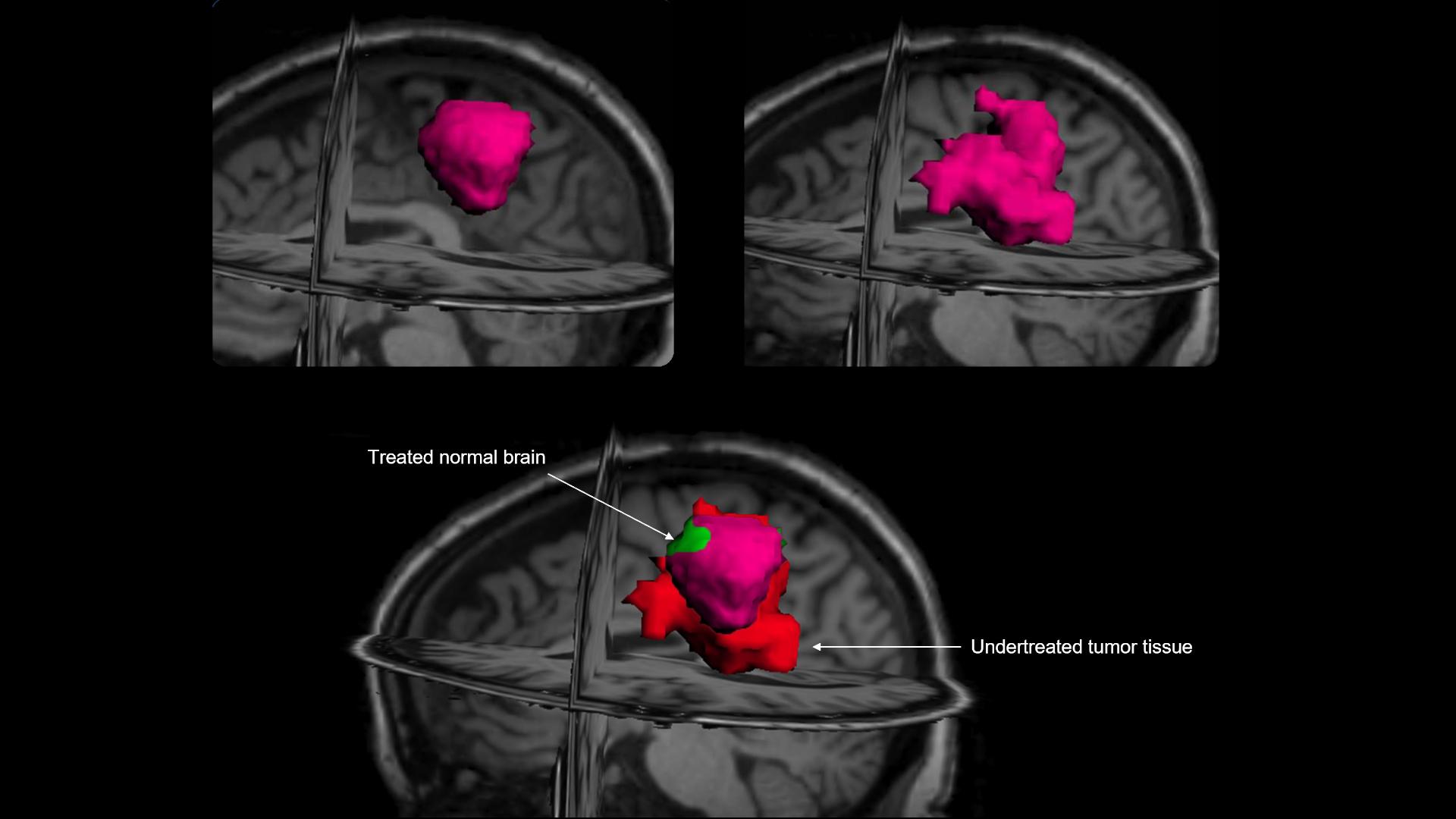 MRI Case Studies, MRI Case Study, MRI Case