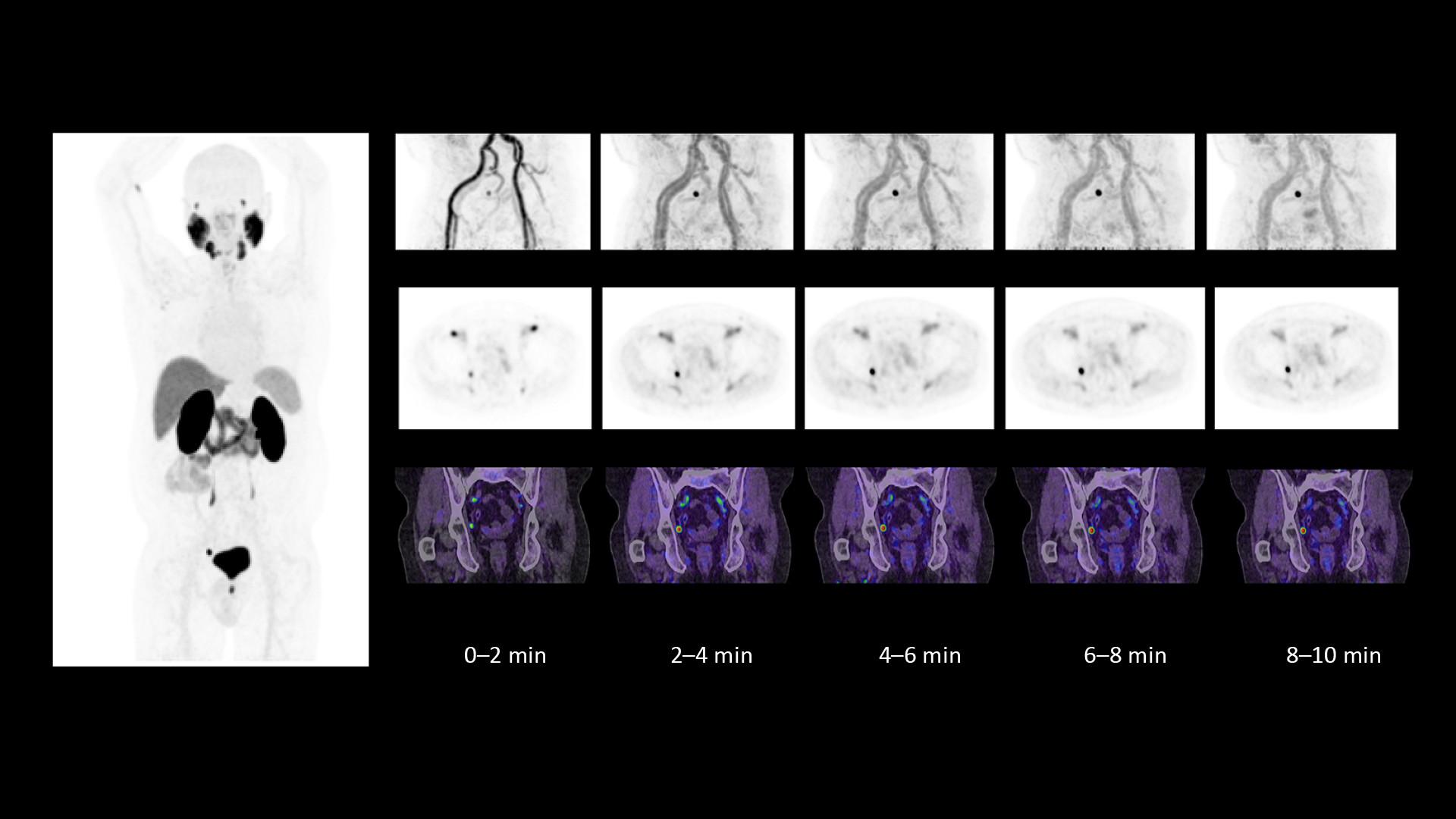 Biograph Trinion PET/CT scanner - Siemens Healthineers