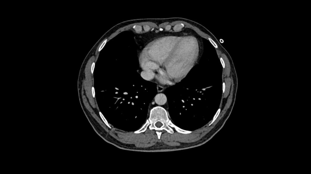 The Siemens Healthineers CT Imaging Chain - Siemens Healthineers