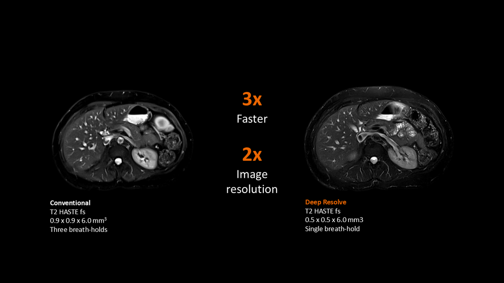 MAGNETOM Altea 新時代に求められる生産性と再現性 - Siemens Healthineers Japan